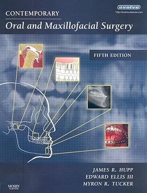Booktopia - Contemporary Oral and Maxillofacial Surgery by James R. Hupp, 9780323049030. Buy ...